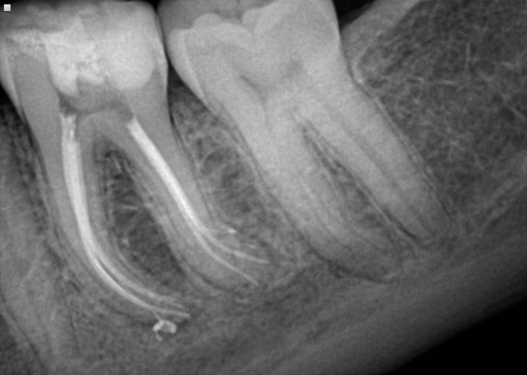 Advanced Technology - Honolulu Endodontics | Endodontist in Honolulu, HI